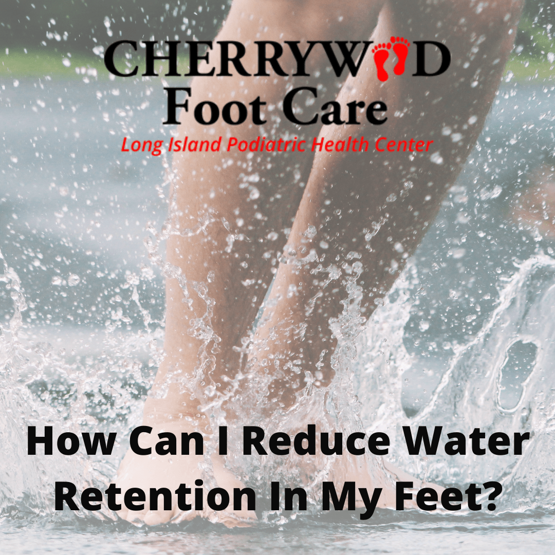 How Can I Reduce Water Retention In My Feet? - Cherrywood Foot Care