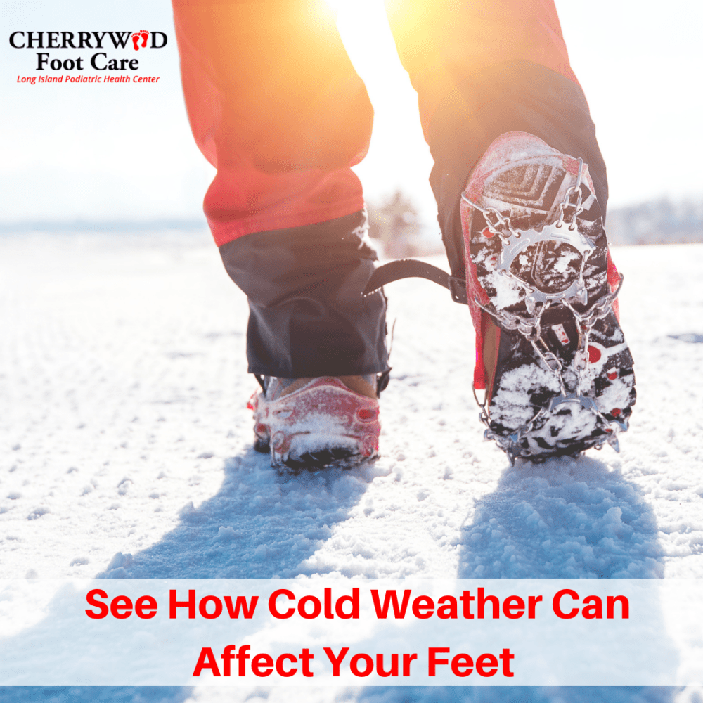 Foot Pain Caused By Cold Weather - Cherrywood Foot Care