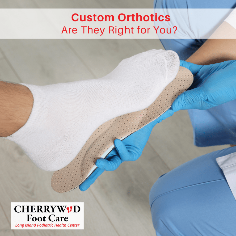 Custom Orthotics: Are They Right for You? - Cherrywood Foot Care